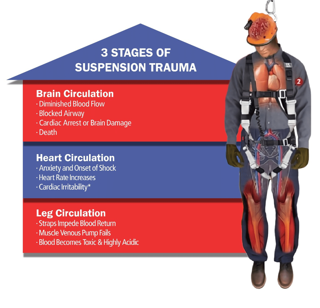 Suspension Trauma: The Hidden Danger of Falls and How to Avoid It ...